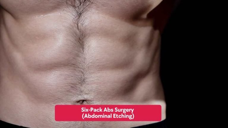 Six Pack Abs Surgery Abdominal Etching Benefits Recovery